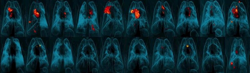 Un estudio muestra que administrar la vacuna contra la tuberculosis por ...