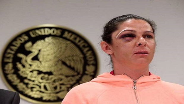 Ana Gabriela Guevara Hace Un Llamado Para Frenar Violencia Contra Las